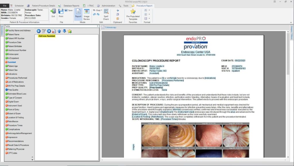 Provation® endoPRO iQ™ | Provation