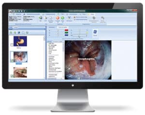 Provation® endoPRO iQ™ | Provation