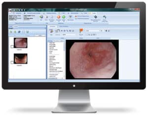 Provation® endoPRO iQ™ | Provation